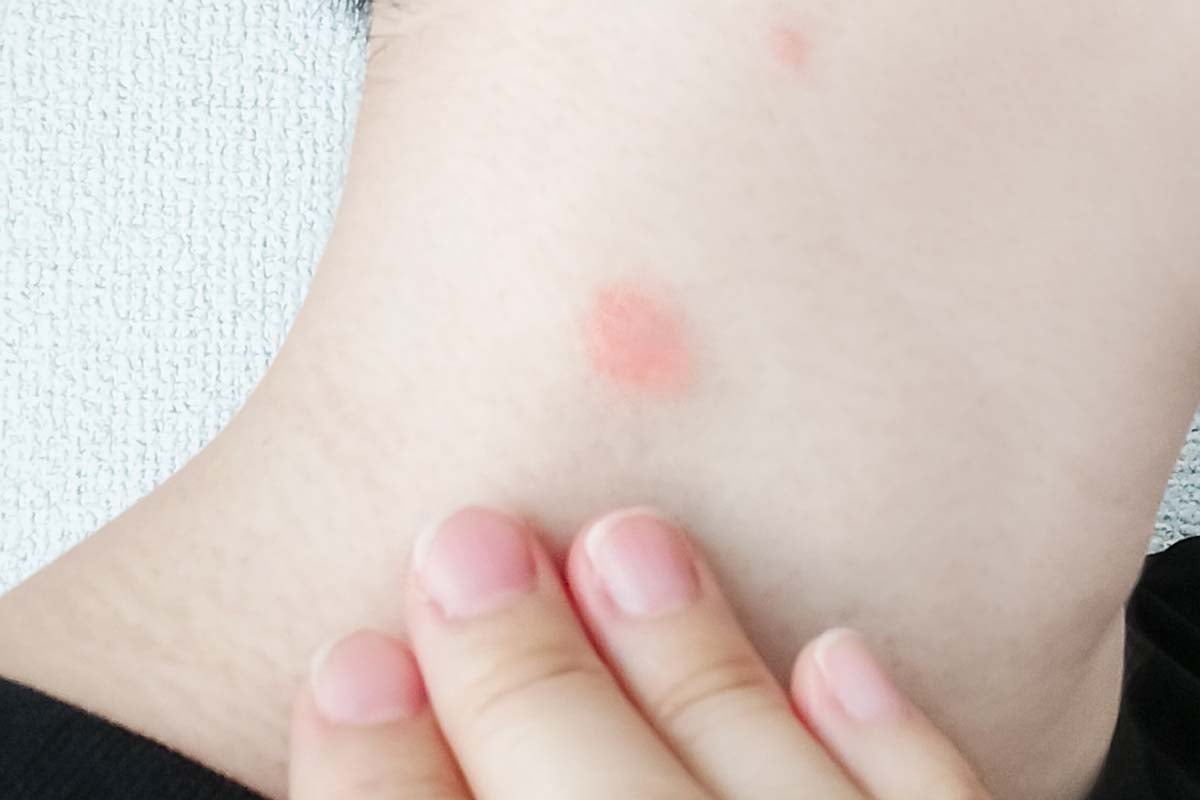 「虫が怖くて事故寸前？」80%の人が嫌う“車内害虫”――夏の運転リスクになる？ 埼玉県調査が警鐘 | Merkmal（メルクマール） - (2)